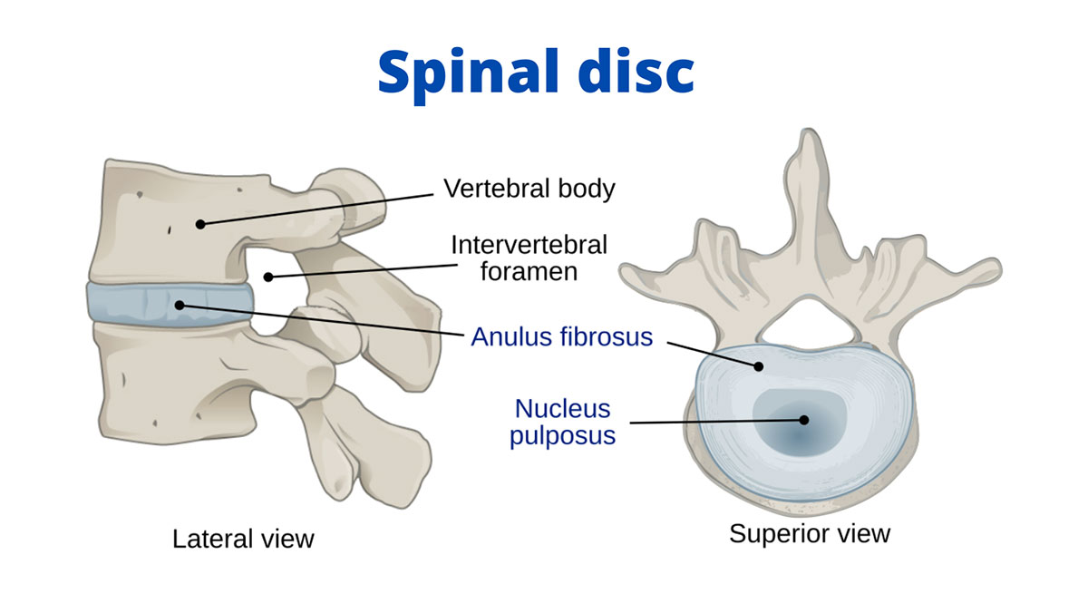 Stem Cell Treatment Prevent Degenerative Disc Disease and Decrease Back ...
